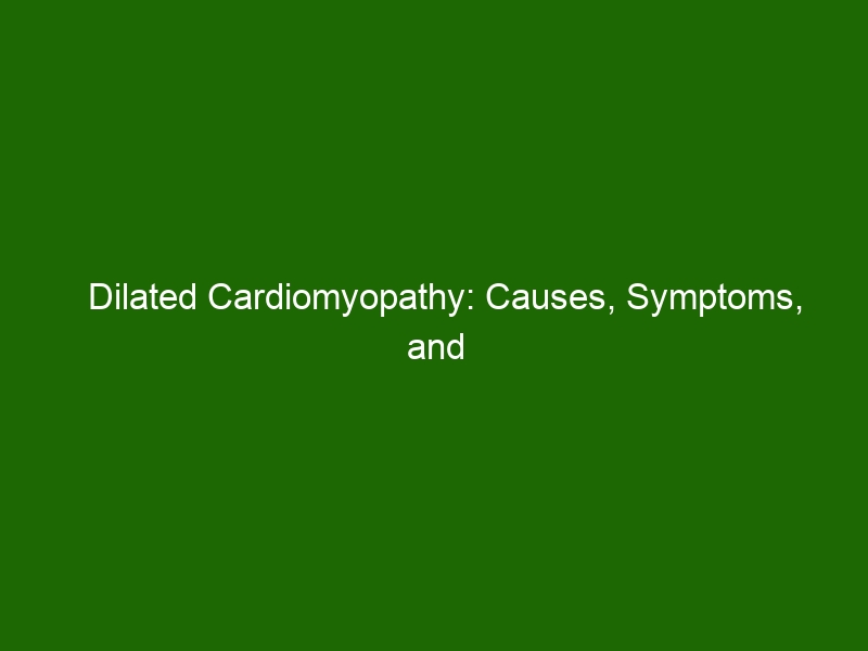 Dilated Cardiomyopathy Causes Symptoms And Treatment Options