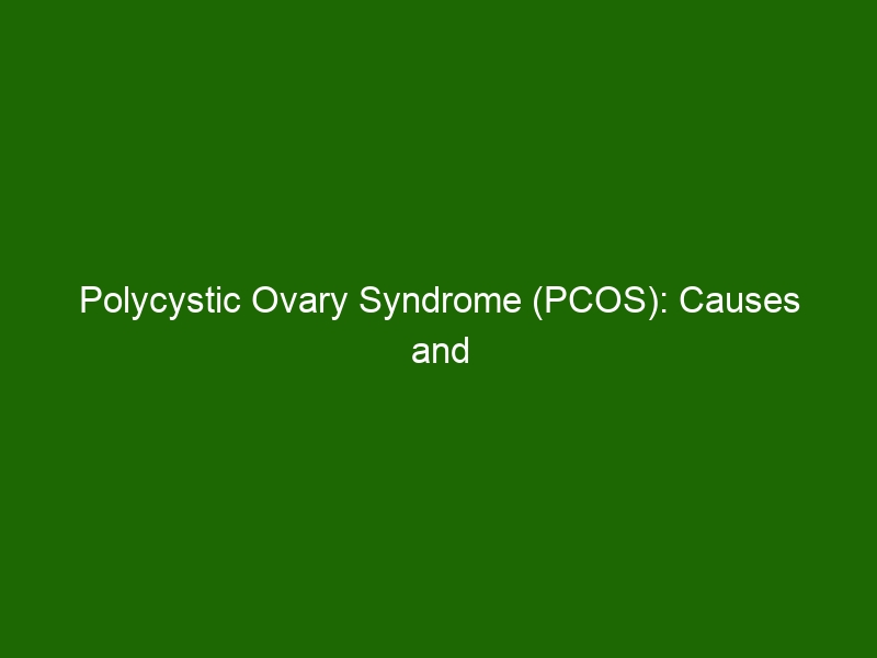 Polycystic Ovary Syndrome Pcos Causes And Management Health And Beauty
